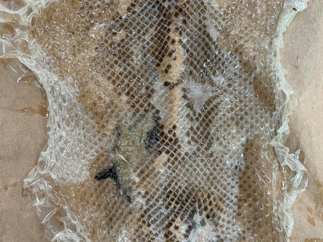 Grimm’s Dermal Necrosis